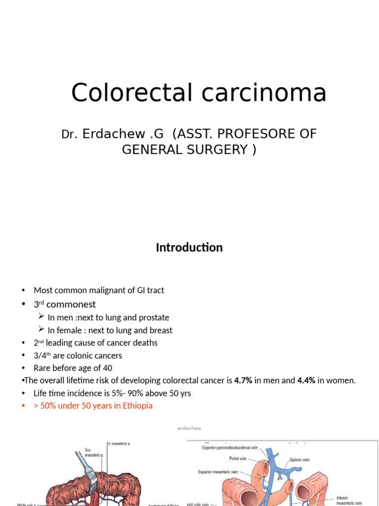 Colorectal Carcinoma | PDF | Colorectal Cancer | Adenoma
