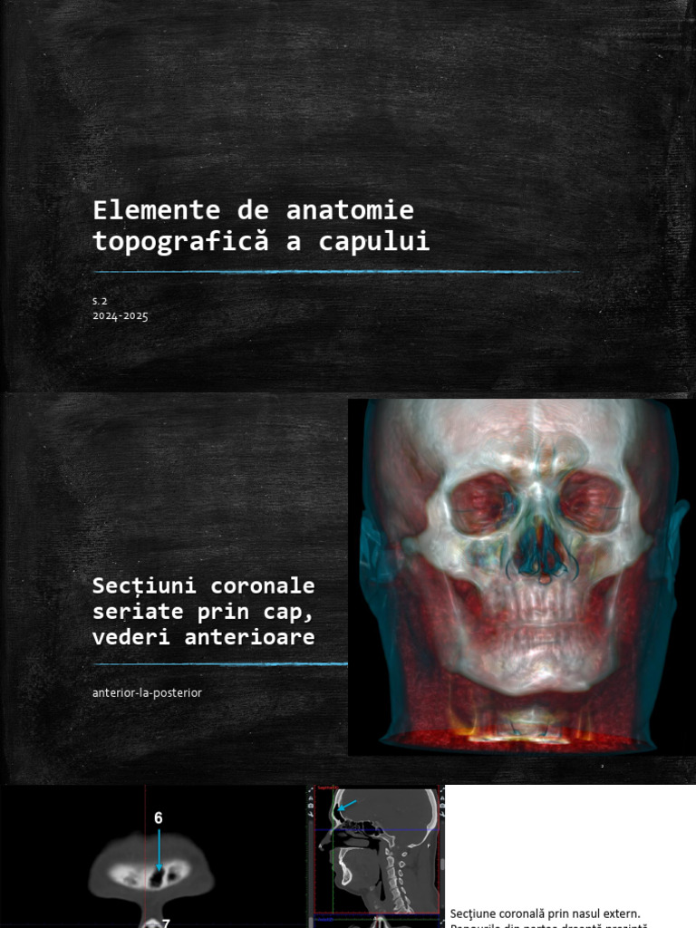 OPT 4 Sectiuni Ale Capului Elemente de Anatomie Topograficä A Capului | PDF