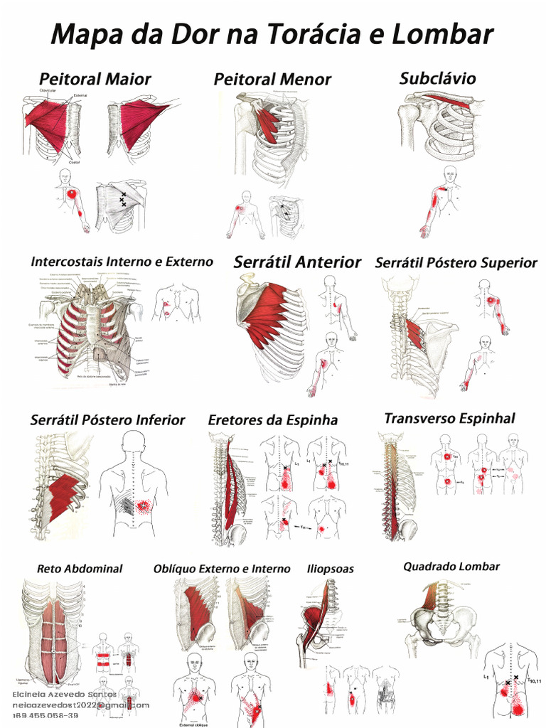 Mapa de Dor em ToraÃ - Â - Cica e Lombar | PDF