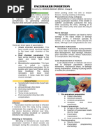 Precautions Taken With Pacemaker Patients Using Ultrasonic Scaler | PDF ...