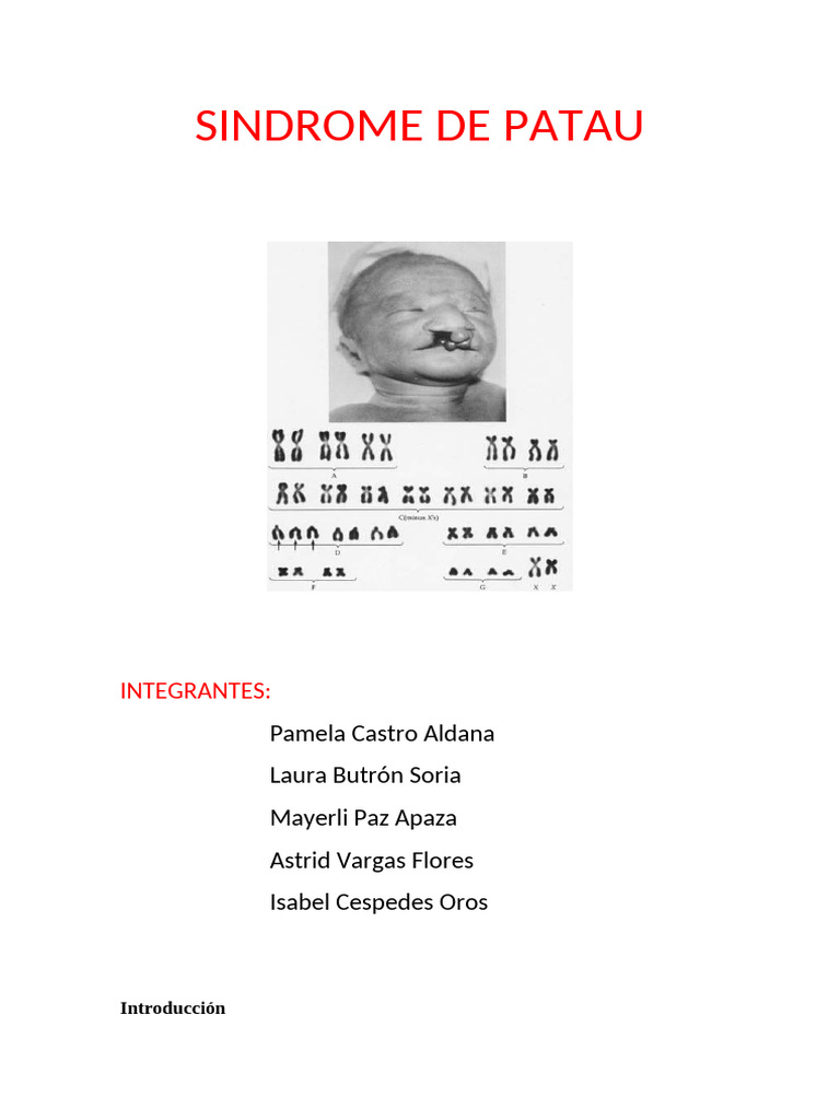 Sindrome de Patau | PDF | Medicina | Medicina CLINICA