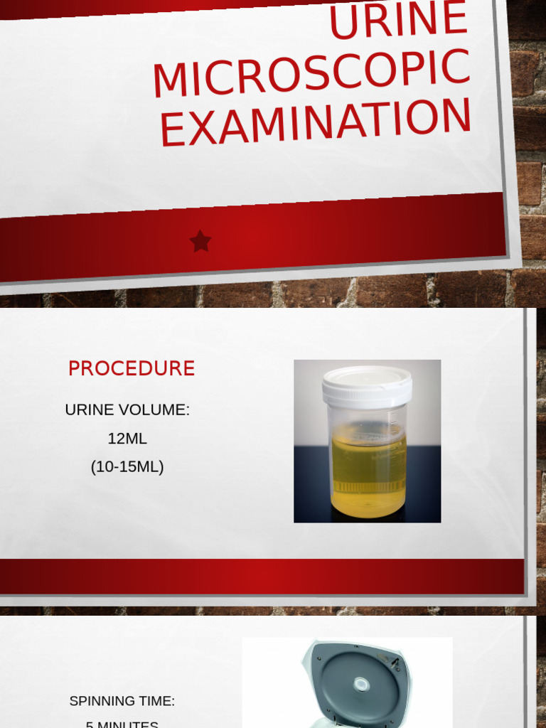 Urine Microscopic Examination | PDF | Staining | White Blood Cell