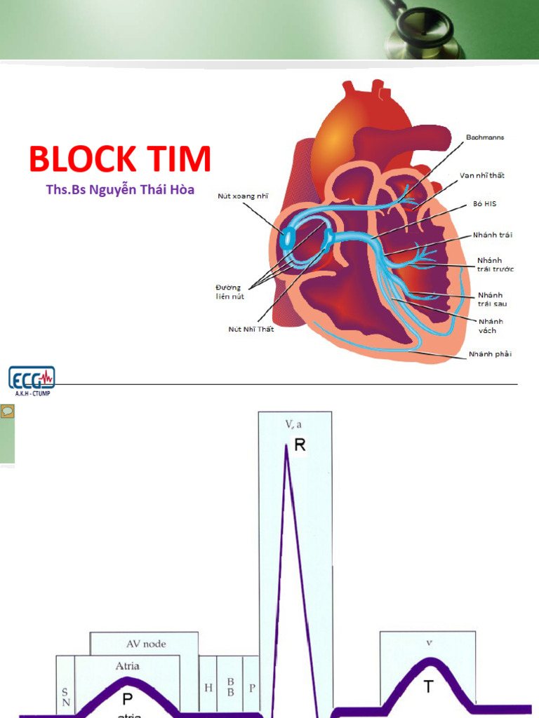 Block Heart | PDF
