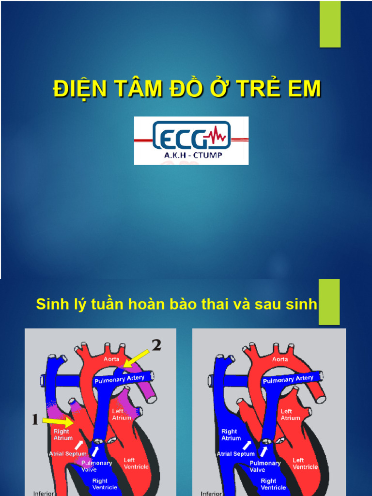 Ecg Tre em | PDF
