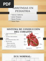 Tipos de Ritmos Cardíacos y Bloqueos AV | PDF