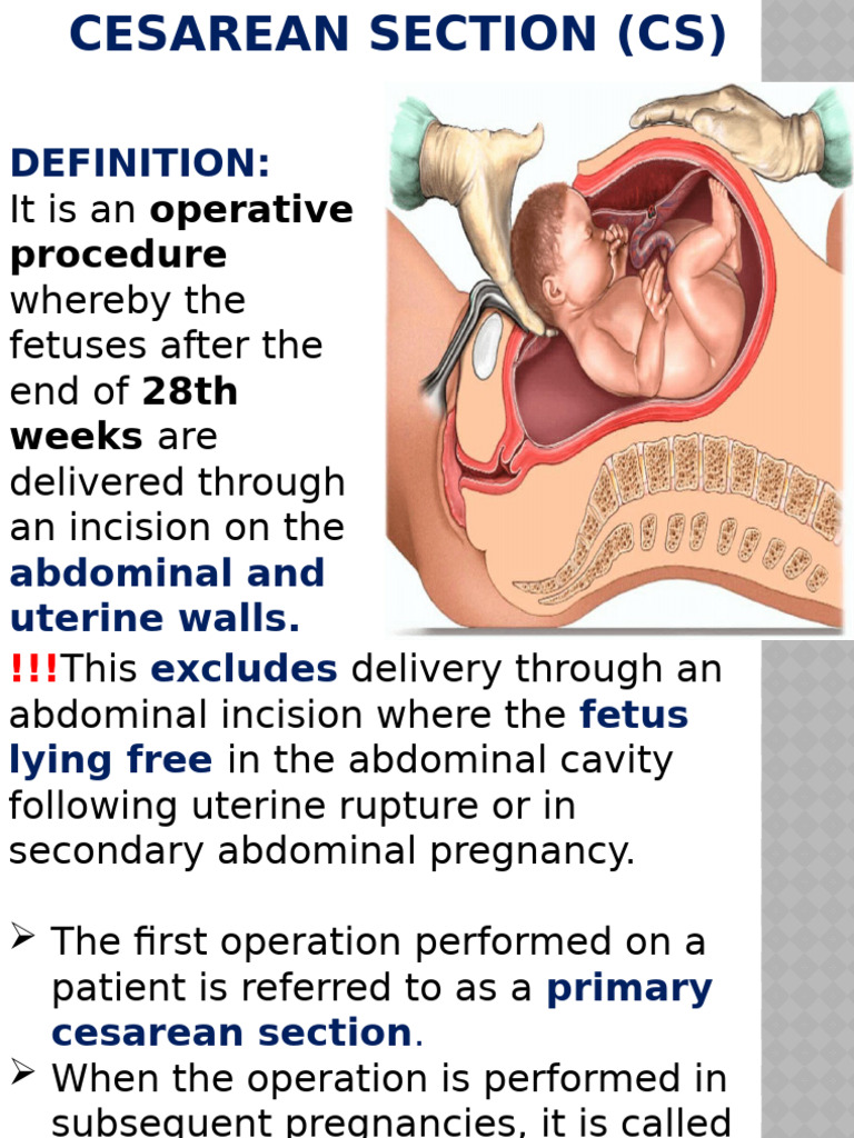 Cesarean Section-14 2 | PDF | Caesarean Section | Childbirth
