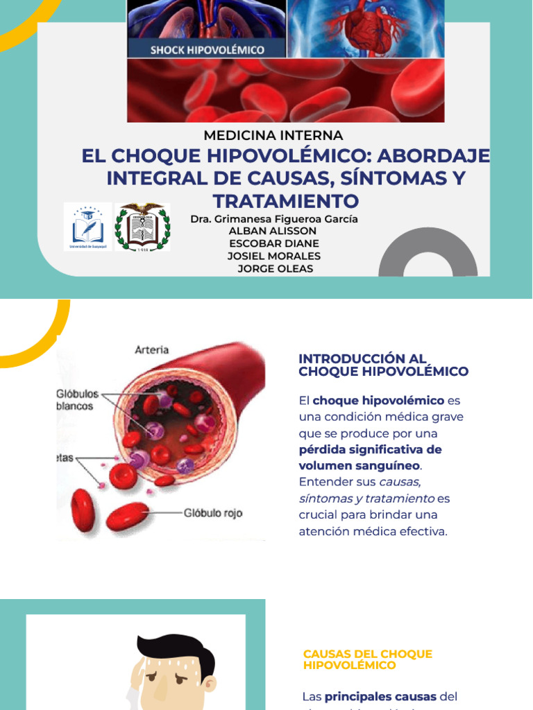 Manejo del Choque Hipovolémico | PDF