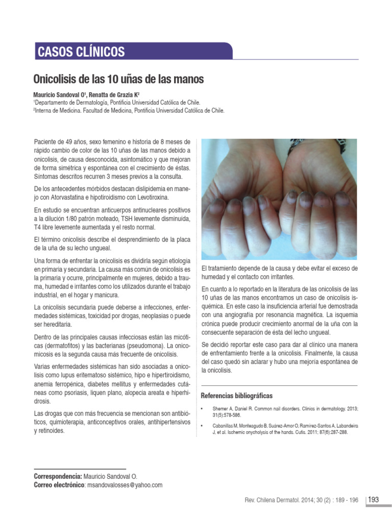 Casos Clínicos: Onicolisis de Las 10 Uñas de Las Manos | PDF | Clavo ...