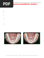 Mandibular Molar Anatomy Overview | PDF | Dental Anatomy | Dentistry ...