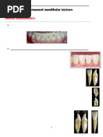 Maxillary Injections Cheat Sheet | PDF | Dentistry | Dentistry Branches