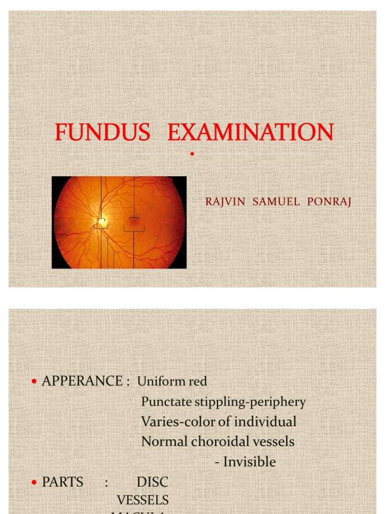 Fundus Examination | PDF