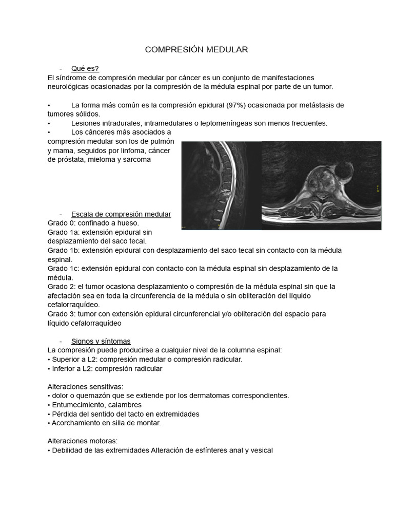 Tele. Compresión Medular | PDF | Cáncer | Médula espinal