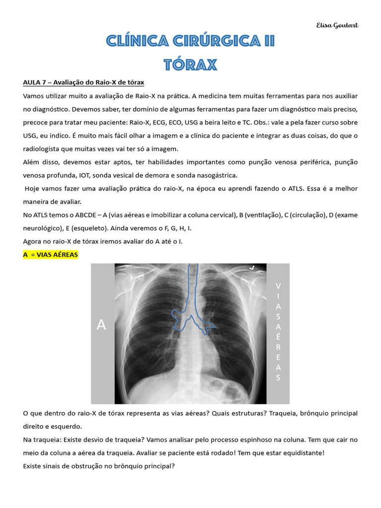 Aula 7 Avaliação de Raio X | PDF | Medicina Clínica | Especialidades ...