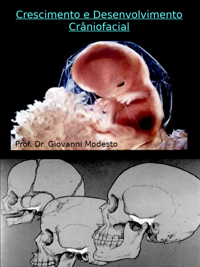 Crescimento Craniofacial: Fundamentos e Mecanismos | PDF | Osso ...