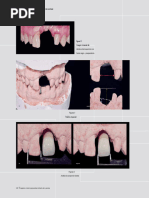 Exocad Manual How-to-install-Libraries Es Screen | PDF | Biblioteca ...