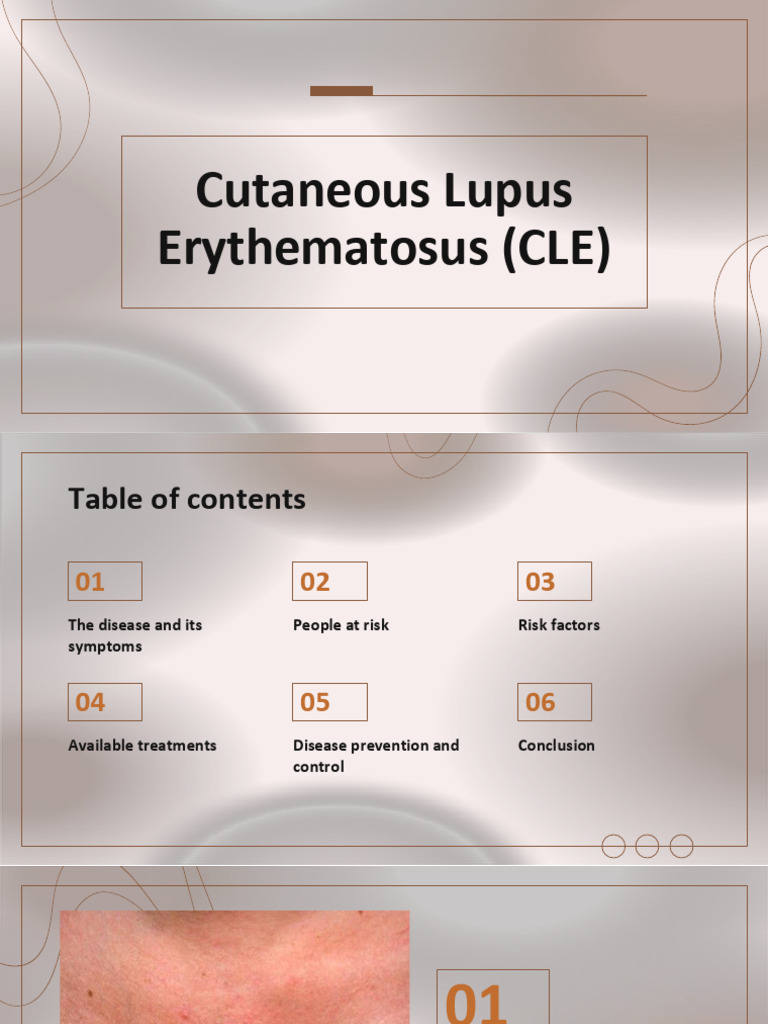 Non-Scarring Alopecia in Lupus | PDF | Diseases And Disorders ...