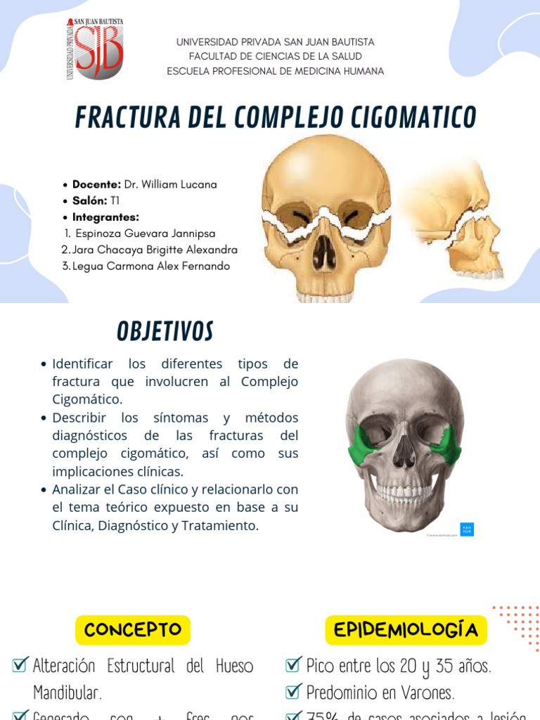 Fractura Complejo Cigomático: Diagnóstico y Tratamiento | PDF ...