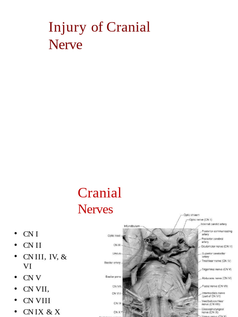 Cranial Nerve Injuries | PDF | Olfactory System | Human Head And Neck