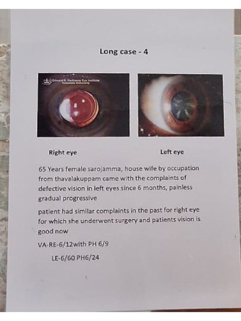 Ophthal Long Case | PDF