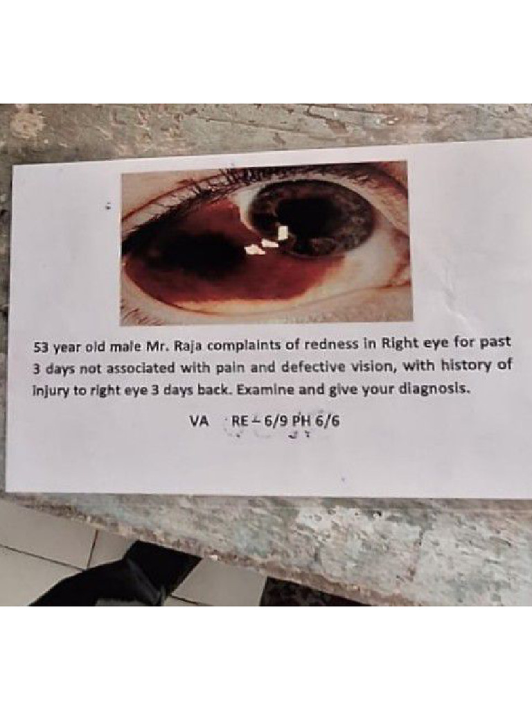 Ophthal Short Case | PDF