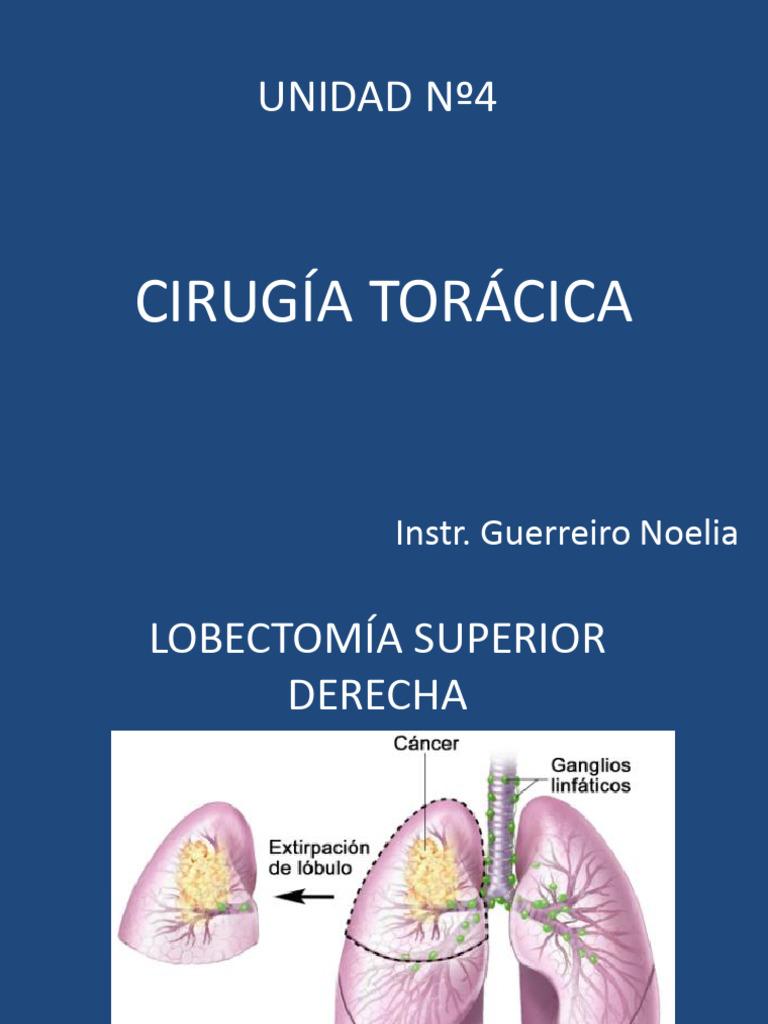 Lobectomía Superior Derecha | PDF | Pulmón