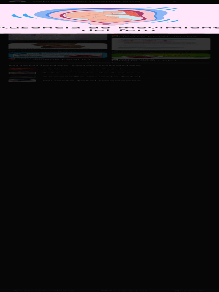 Obito Fetal, Mortinato, Muerte Fetal Anteparto - Buscar Con Google | PDF