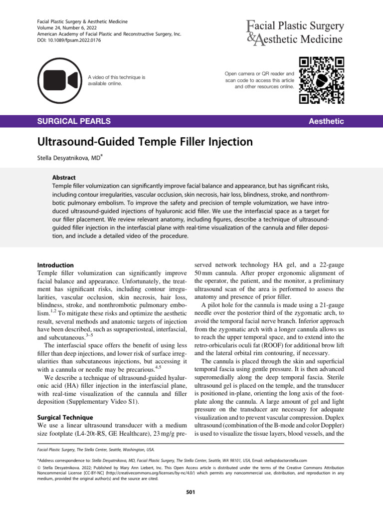 Ultrasound-Guided Temple Filler Injection | PDF | Medical Ultrasound ...