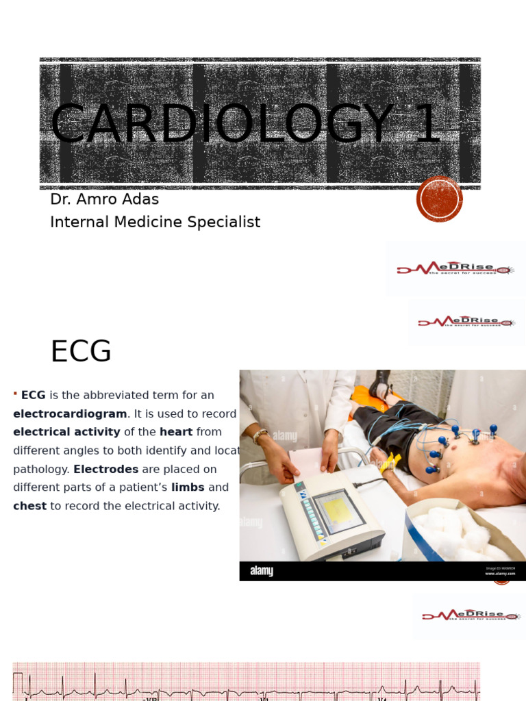 Understanding ECG: Key Components & Interpretation | PDF ...