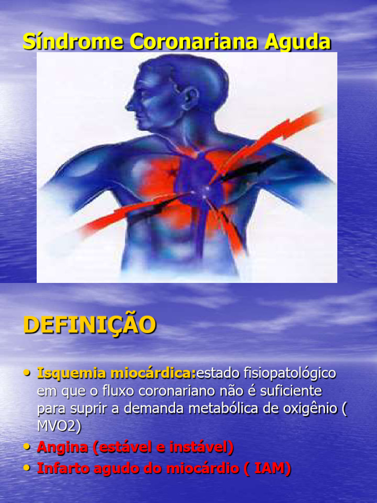 Síndrome Coronariana Aguda: Diagnóstico e Tratamento | PDF | Infarto do ...