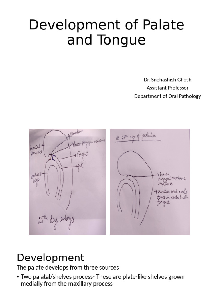 Palate and Tongue Development | PDF | Tongue | Human Head And Neck
