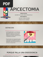 Tecnica de Apexificacionr | PDF