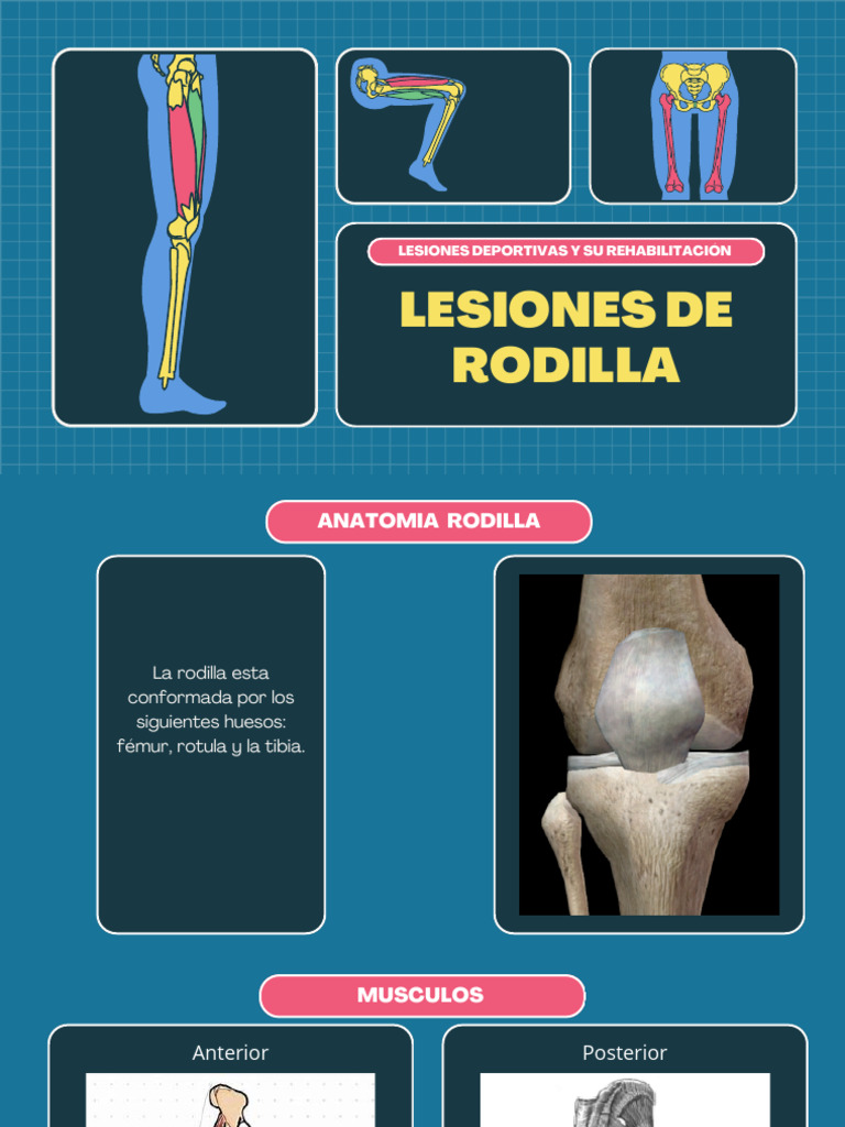 Lesiones y Rehabilitación de Rodilla | PDF | Rodilla | Osteoartritis