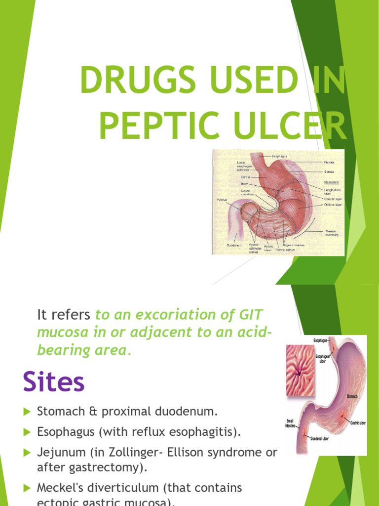 Peptic Ulcer | PDF | Gastroesophageal Reflux Disease | Stomach
