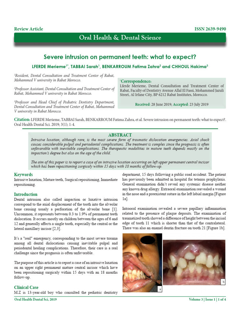 Severe Intrusion On Permanent Teeth What To Expect | PDF | Human Tooth ...
