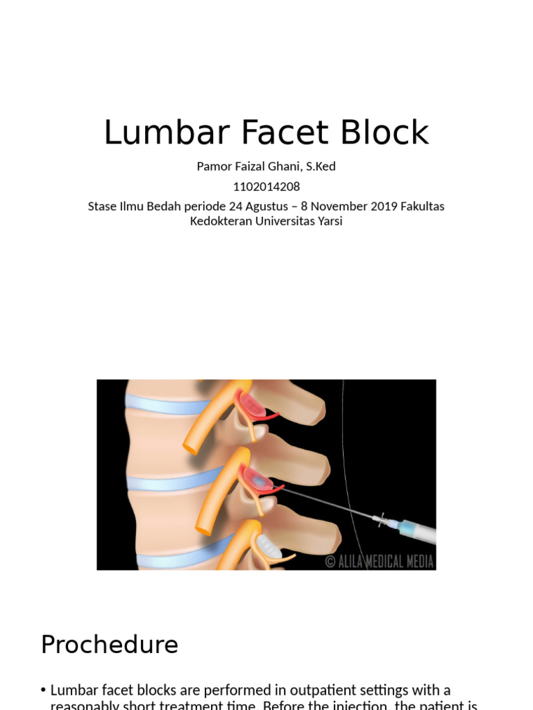 Lumbar Facet Block | PDF