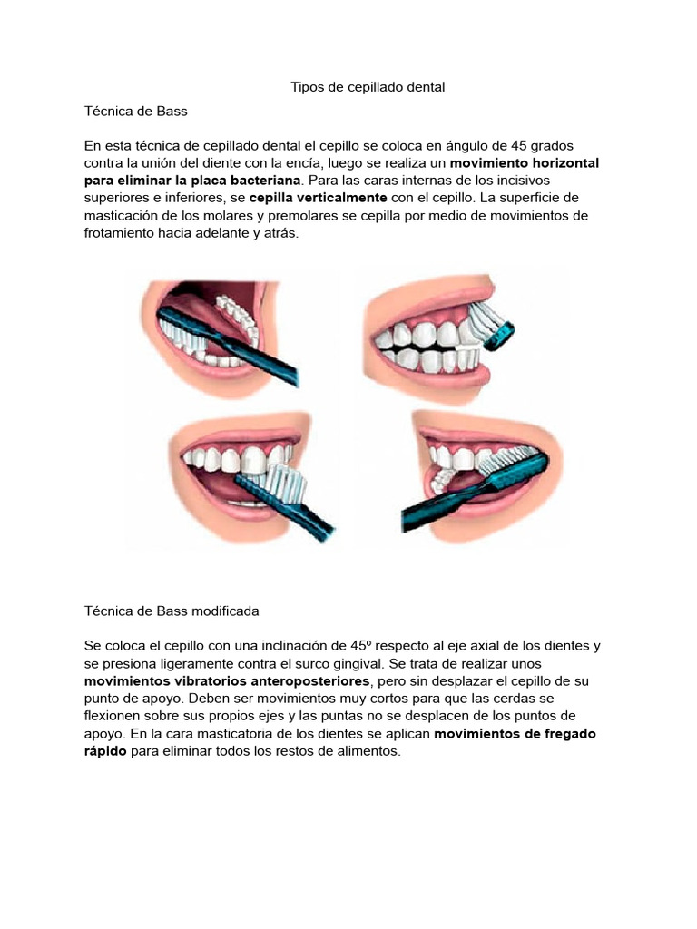 Tipos de Cepillado Dental - Periodoncia | PDF | Diente | Odontología
