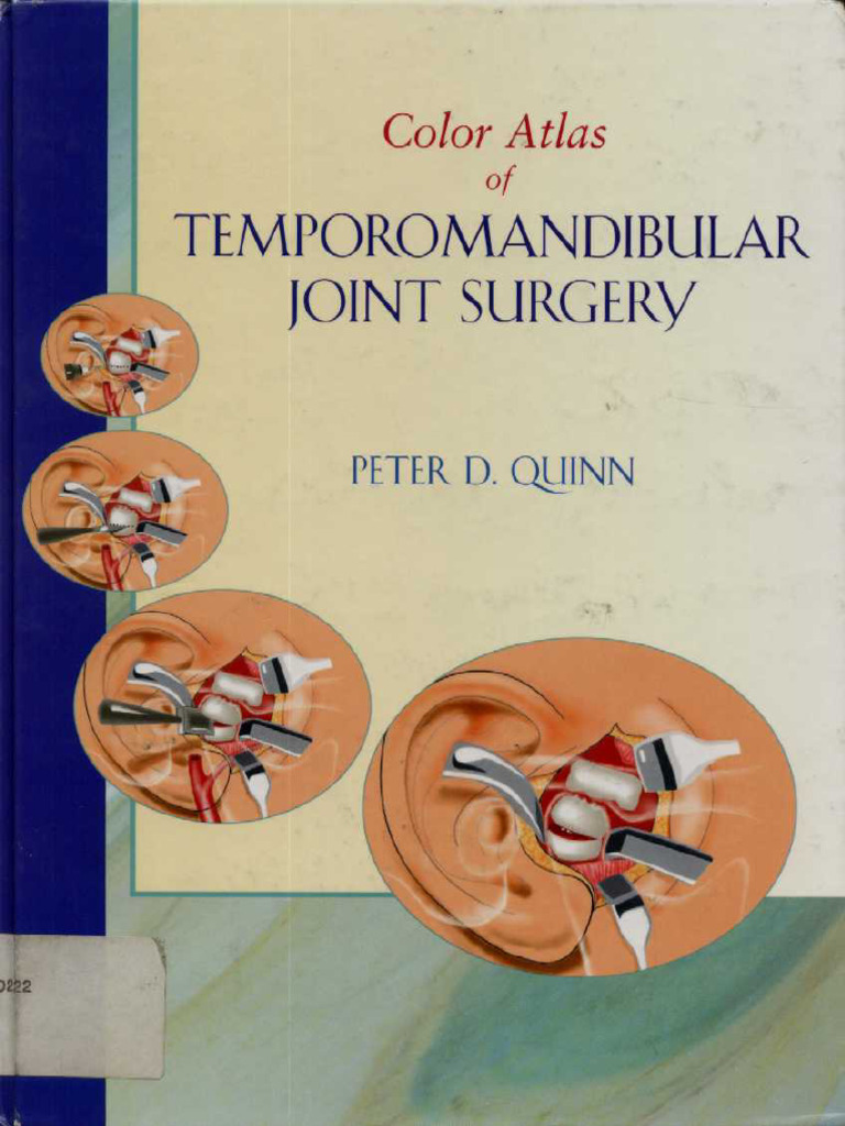 Color Atlas of Temporomandibular Joint Surgery | PDF