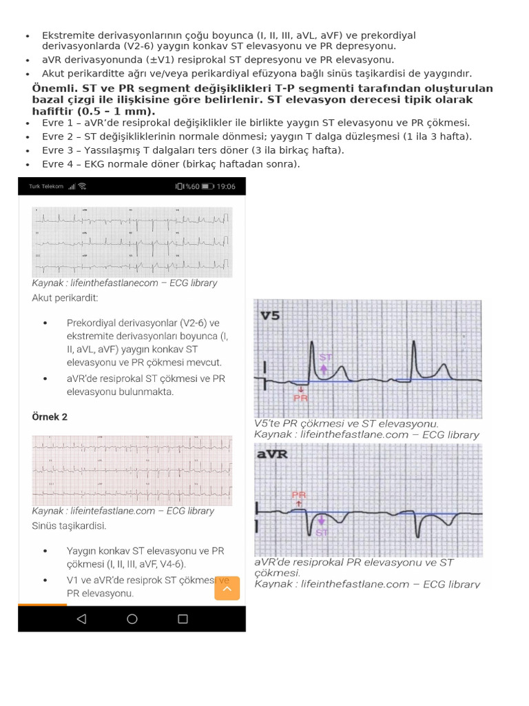 Ste Perikardit | PDF