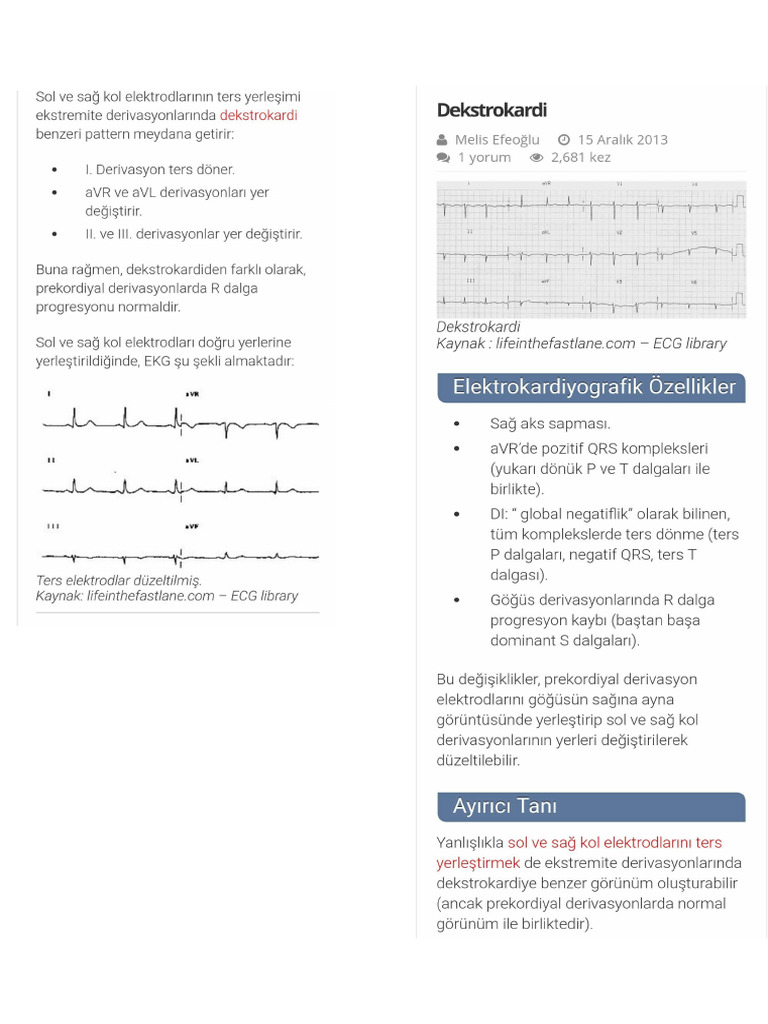 Ekg | PDF
