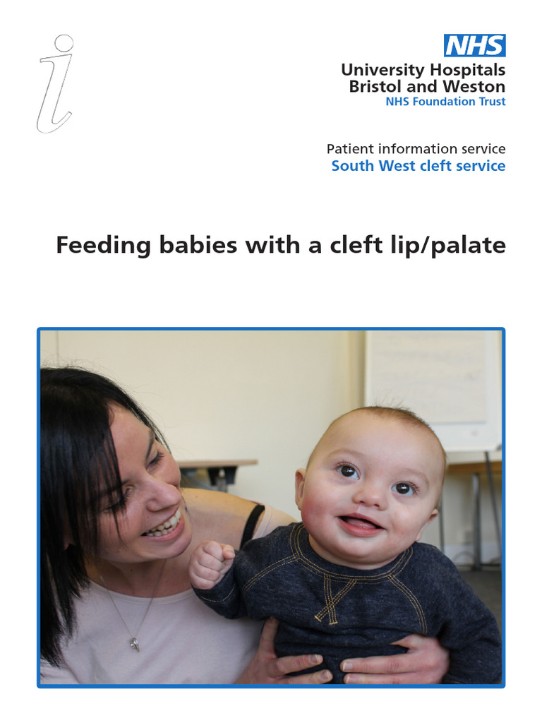 Feeding Babies With A Cleft Lip Palate-1 | PDF | Breastfeeding | Breast ...
