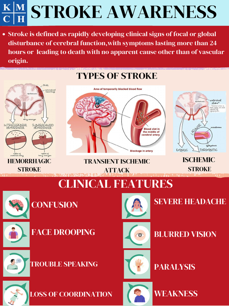 Stroke Awareness Poster | PDF