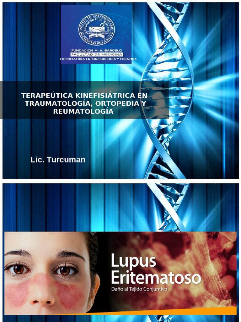 Lupus | PDF | Enfermedades y trastornos | Medicina CLINICA