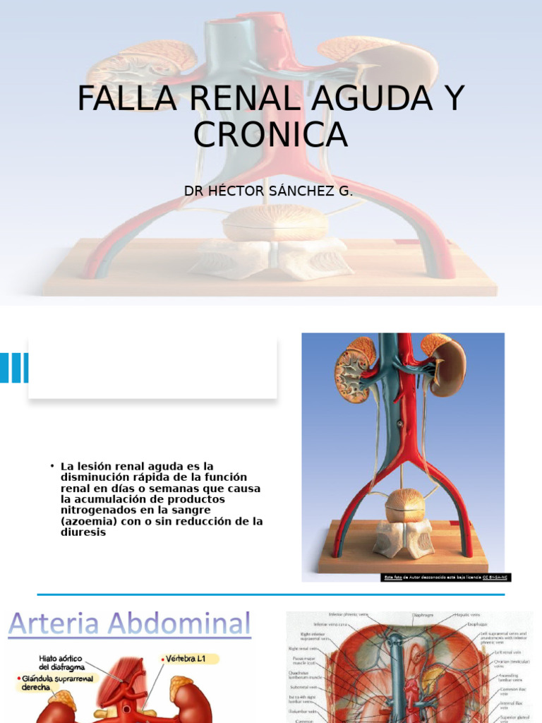 Falla Renal Aguda y Cronica | PDF | Droga anti-inflamatoria libre de ...