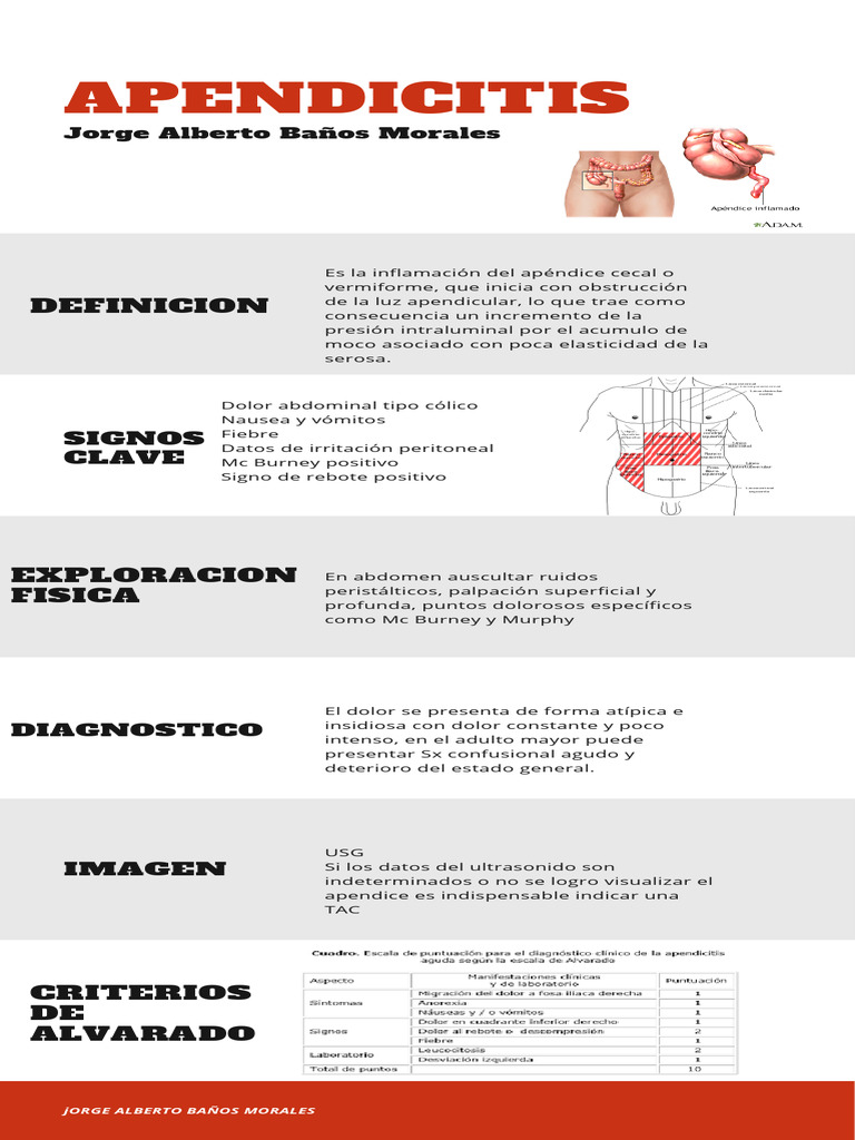 Apendicitis Aguda | PDF