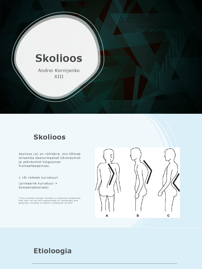 Skolioos | PDF