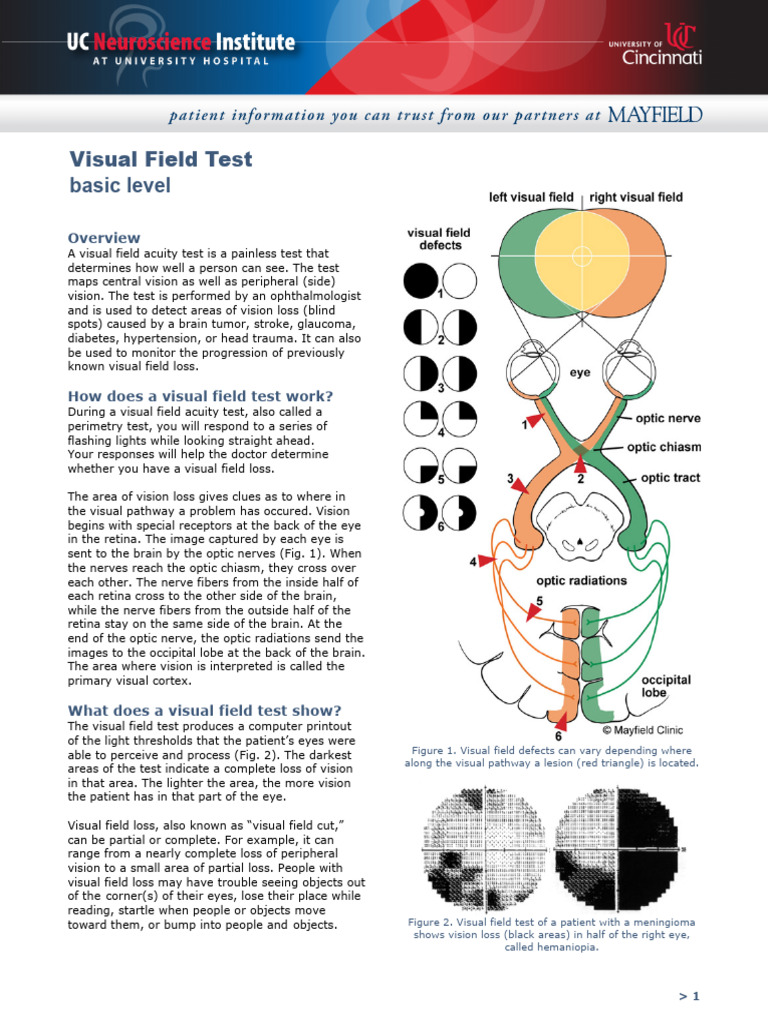 PE VisualFieldTest | PDF | Visual System | Visual Acuity