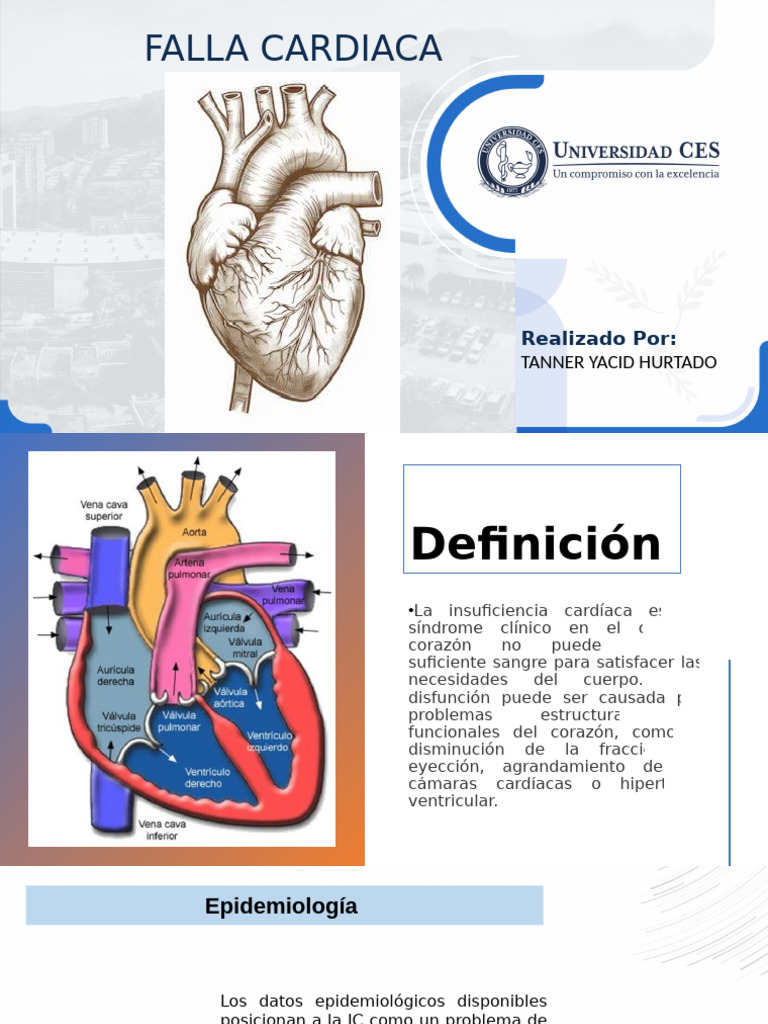Insuficiencia Cardíaca: Causas y Tratamiento | PDF | Corazón ...