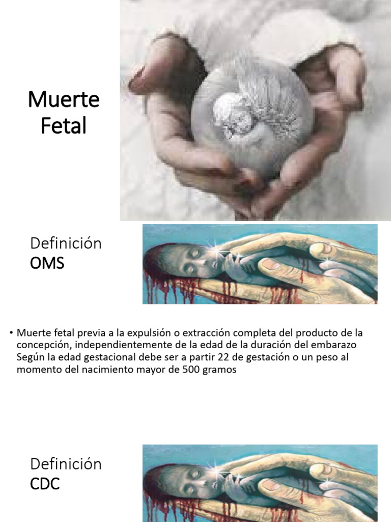 Muerte Fetal: Definición y Factores | PDF | El embarazo | Feto