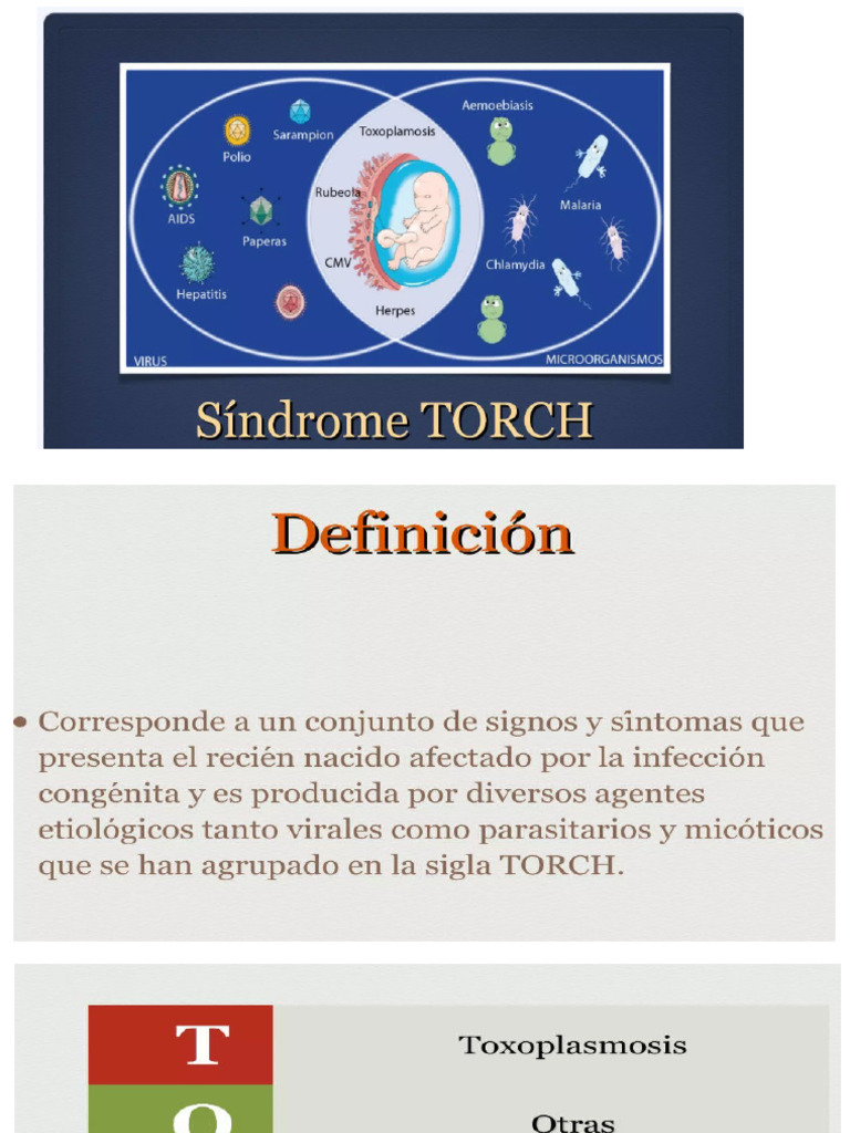 TORCH | PDF