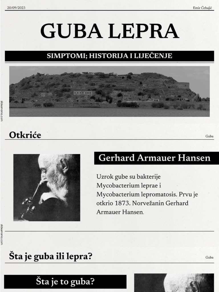 Guba Lepra Prezentacija | PDF